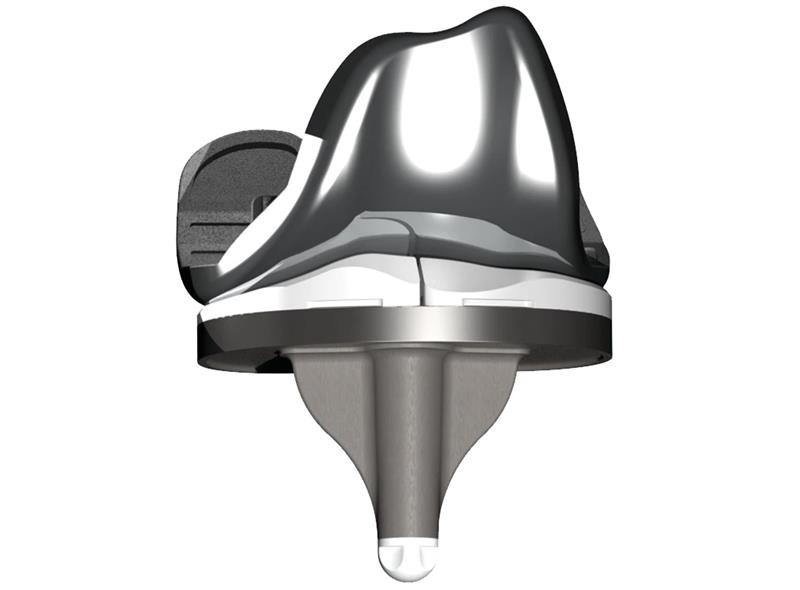 Custom Knee Implants | restor3d