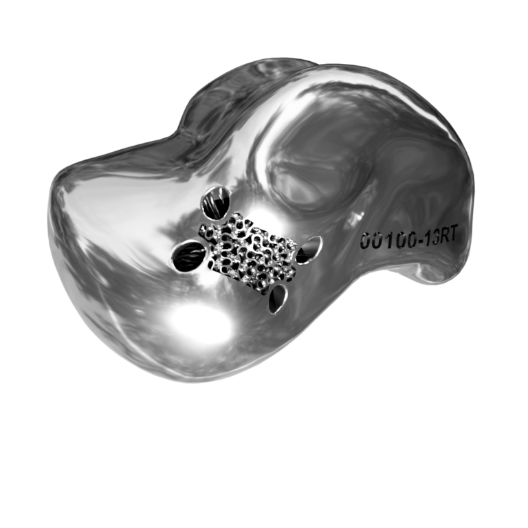 Total Talus Replacement | restor3d